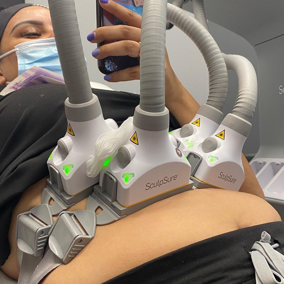 Spring Event Highlighting Chemical Peels and SculpSure, 1720 E Boston ...