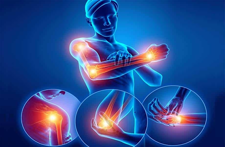 Upper Body Joint Pain Workshop, Sketchley Grange Hotel & Spa, Burbage ...