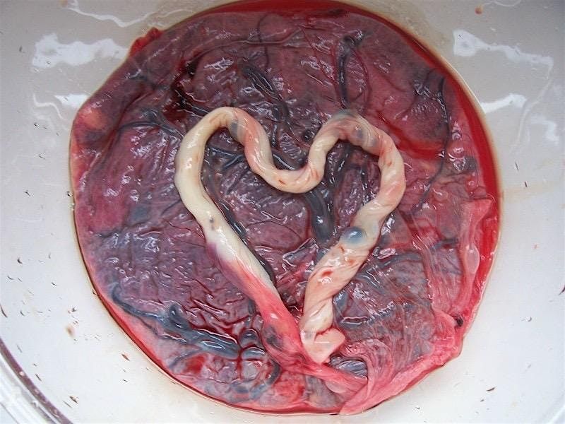 Doulas Night Out: Placentas!, 722 Brooks St, Ann Arbor, 30 January 2026 ...