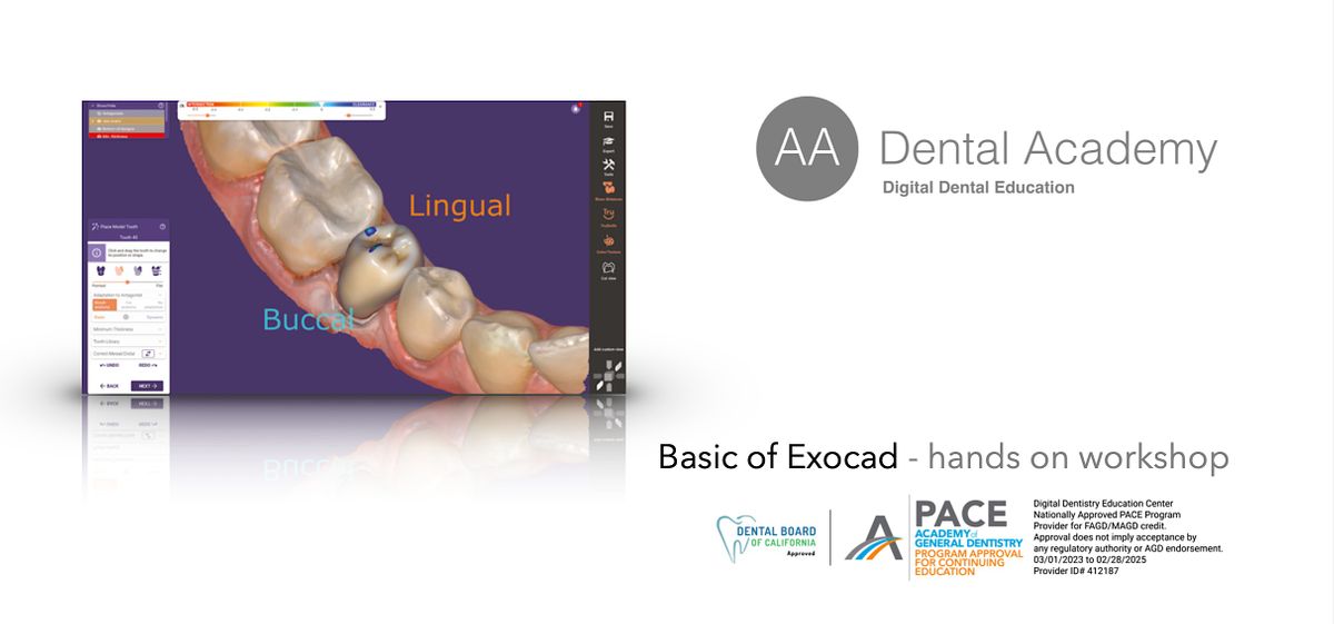 Basic Of Exocad, TruAbutment Inc., Irvine, 12 January to 13 January ...