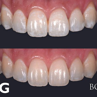 Icon & Whitening Discovery Evening, The Dental Architect, Leeds, 23 May ...