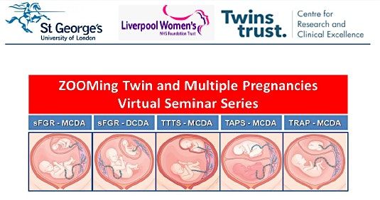 Previable PPROM in singleton and twin pregnancies: Panel discussion ...