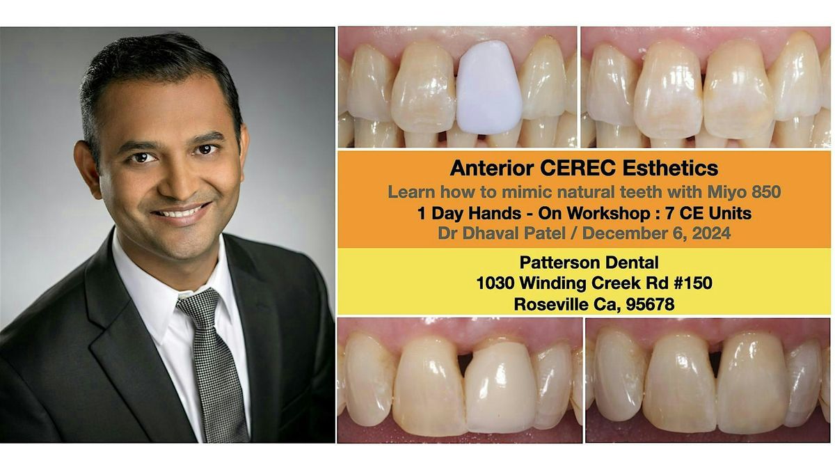 Anterior CEREC Esthetics, Patterson Dental, Roseville, 6 December 2024 ...
