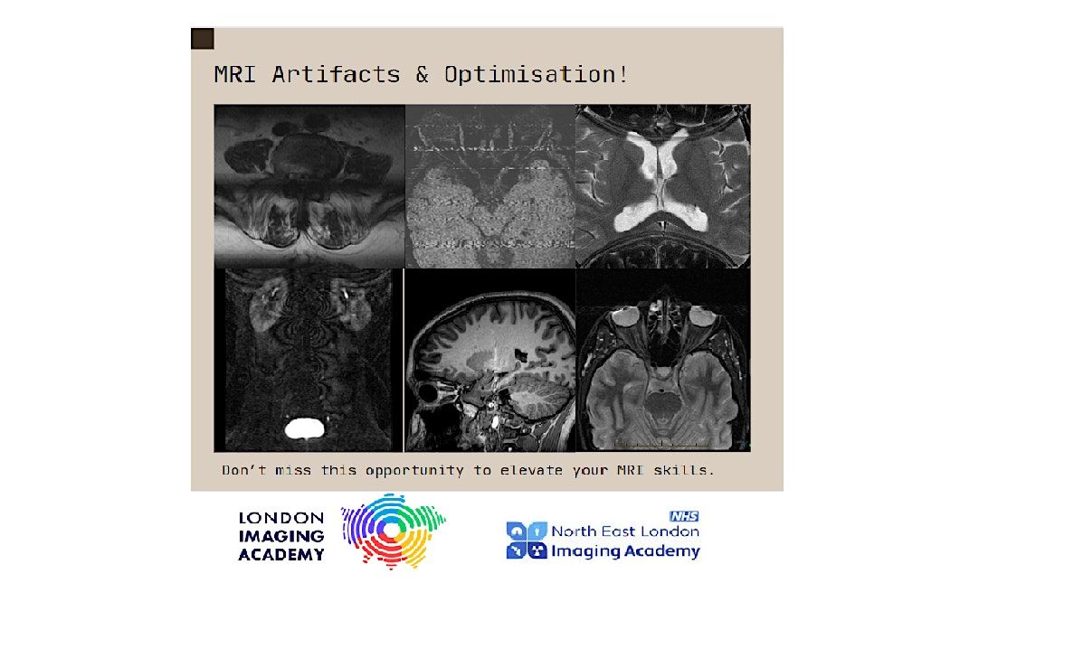 MRI Artefacts and Optimisation, May 1 2024 | Online Event | AllEvents