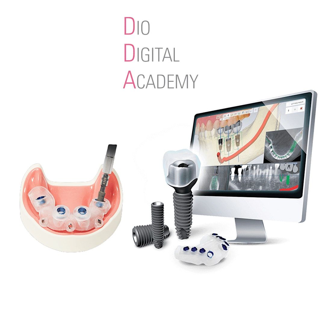 Perfect Placement Digitally Guided Dental Implant System | Sacramento ...