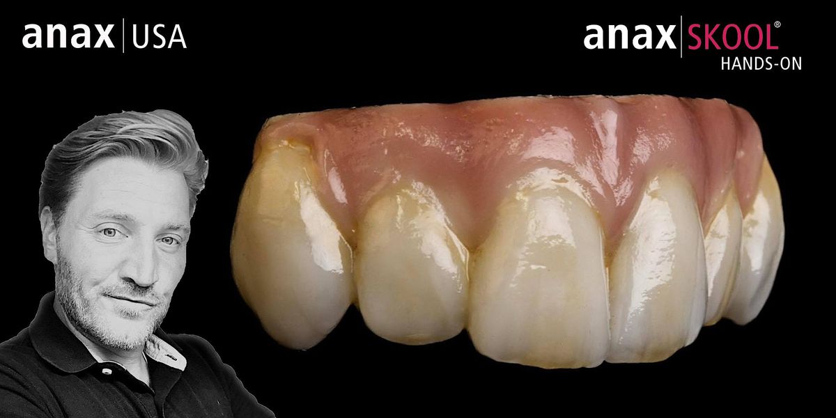 Gingival Micro-Layering in Soprano Surface w/ Florian Steinheber ...