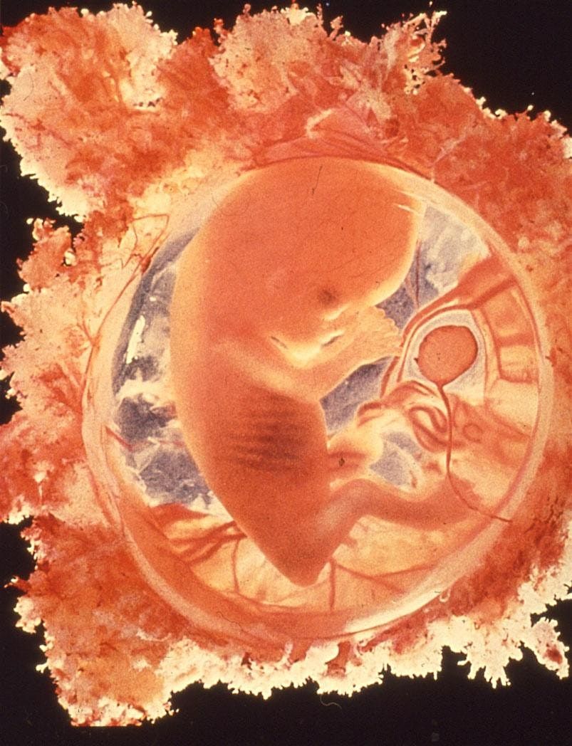 De Mens als Embryo - het Embryo in ons, Badhuisweg 27, Zutphen, 28 ...