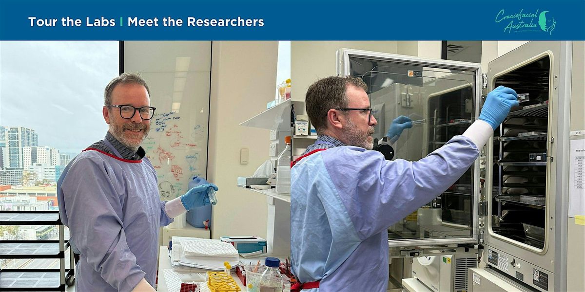 Craniofacial Australia - Lab Tours & Meet the Researchers, Bradley ...